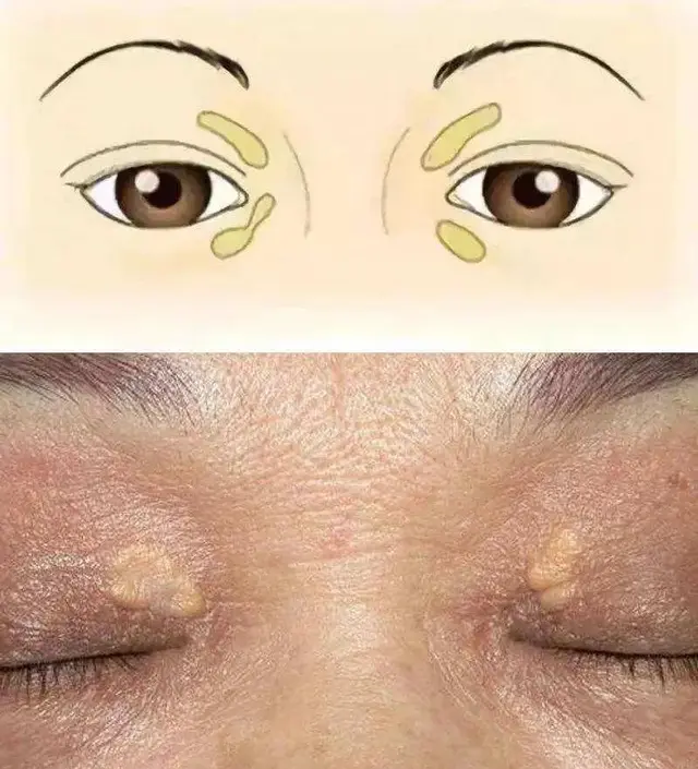 Lan: Of course, this is not a problem for Dr. Lan. It is not very ...