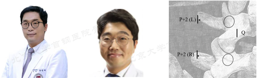 UBE/BESS下腰椎融合术的种类、溯源及对比（上） - 标件库